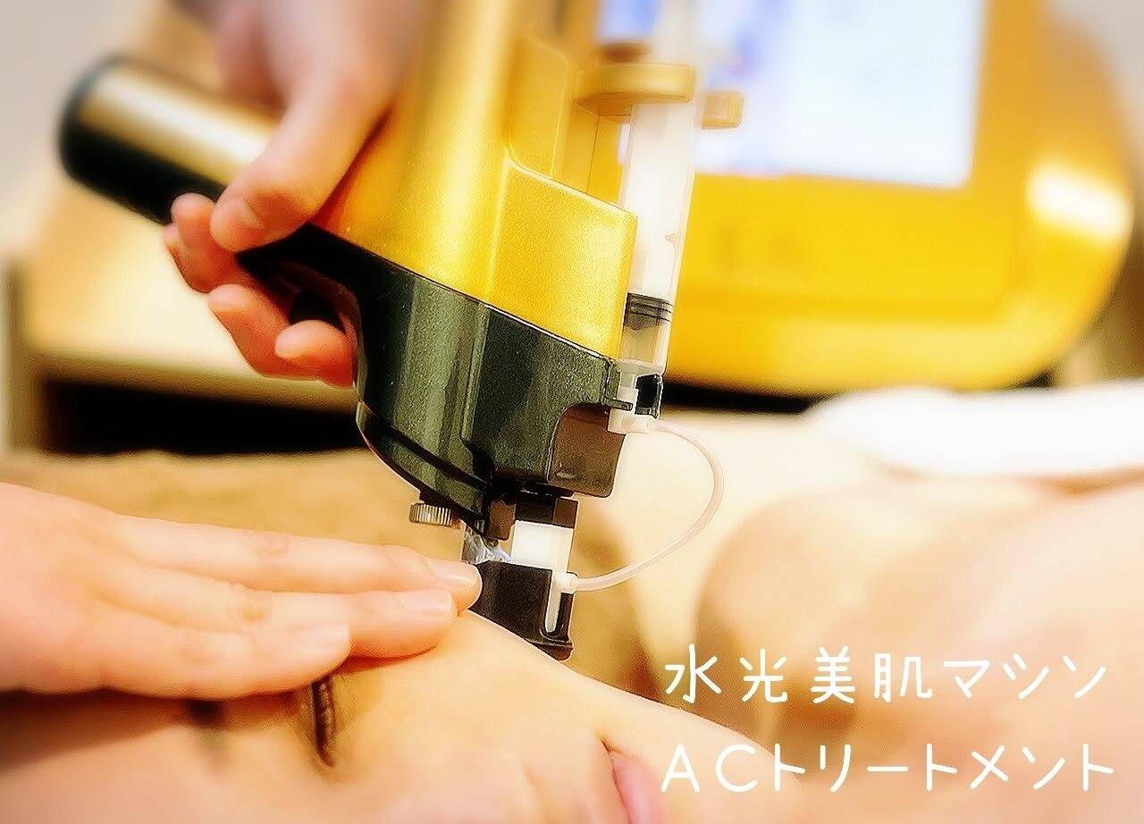 ACマシン★究極のエイジレス肌に | ギャラリー | 前橋市のエステならエステティック～Lunon～